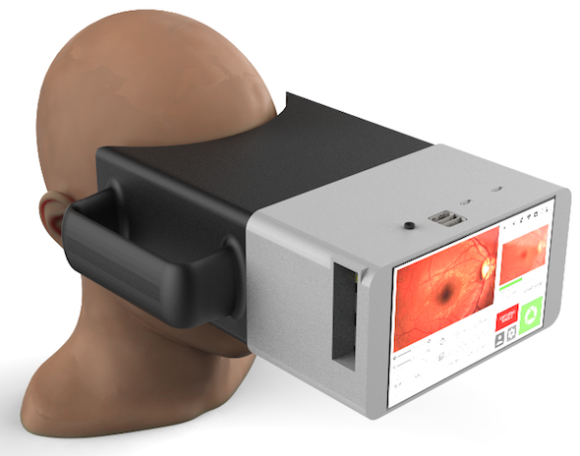 Open Indirect Ophthalmoscope is a portable screening device for retinal ...
